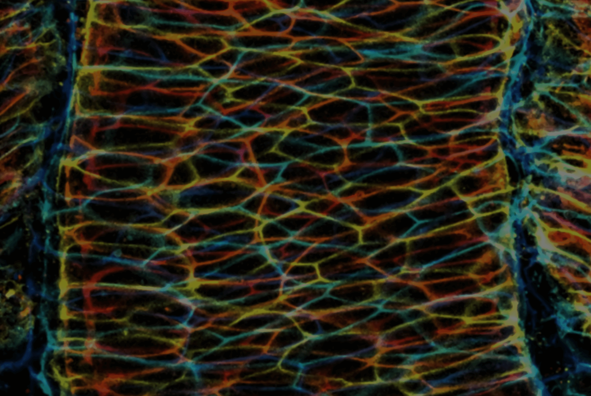 Shinuo Weng | TMML – Tissue Morpho & Mechanics Lab